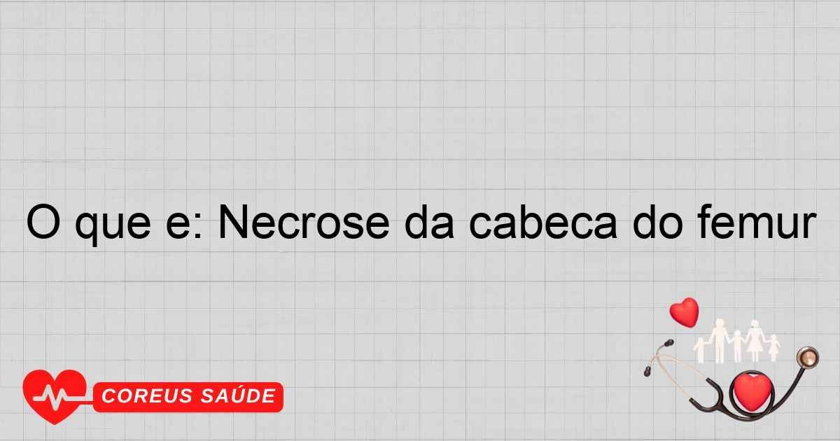 O Que é: Necrose Da Cabeça Do Fêmur - Entenda
