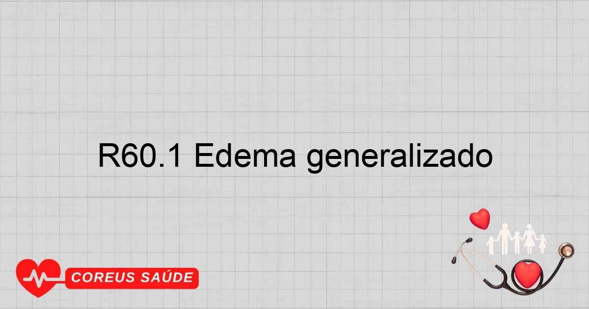 R60.1 Edema Generalizado: Causas E Tratamento
