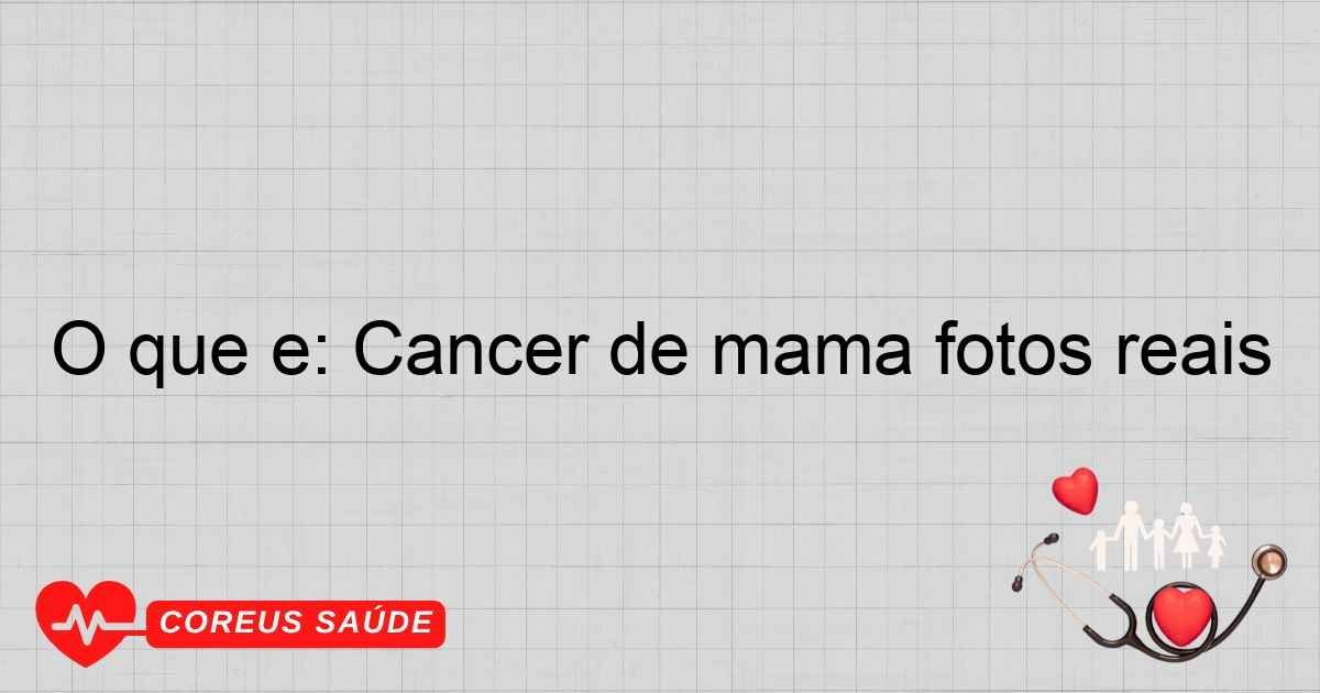 O Que é: Câncer De Mama Fotos Reais E Suas Implicações
